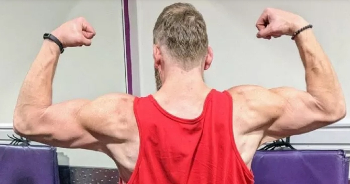 2년만 152kg 뺐다...급격한 체중 감량의 결과는?