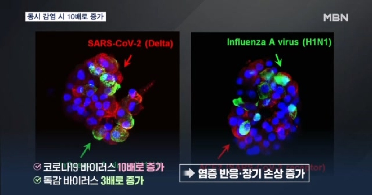 코로나·독감 같이 걸리면 바이러스 10배로 증가…중증·사망위험 더 높다