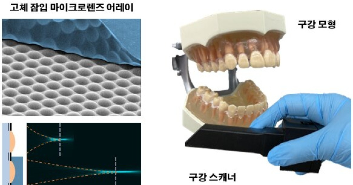 KAIST, 3차원 구강 스캐닝용 휴대용 카메라 개발