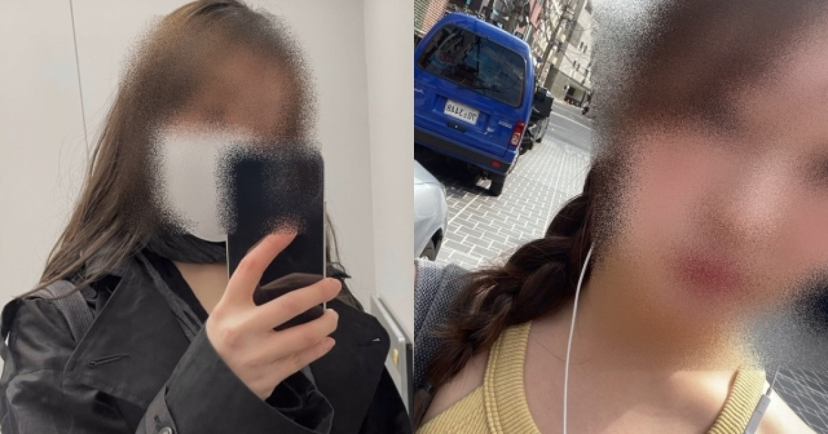 ‘롤스로이스 男 뇌사 추정 피해자 25일 끝내 숨져
