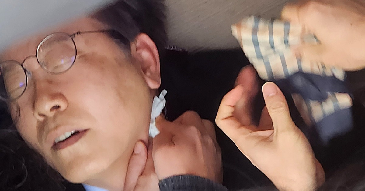 [뉴스1 Pick]이재명 부산 방문 중 피습…목 부위 찔려 병원 이송