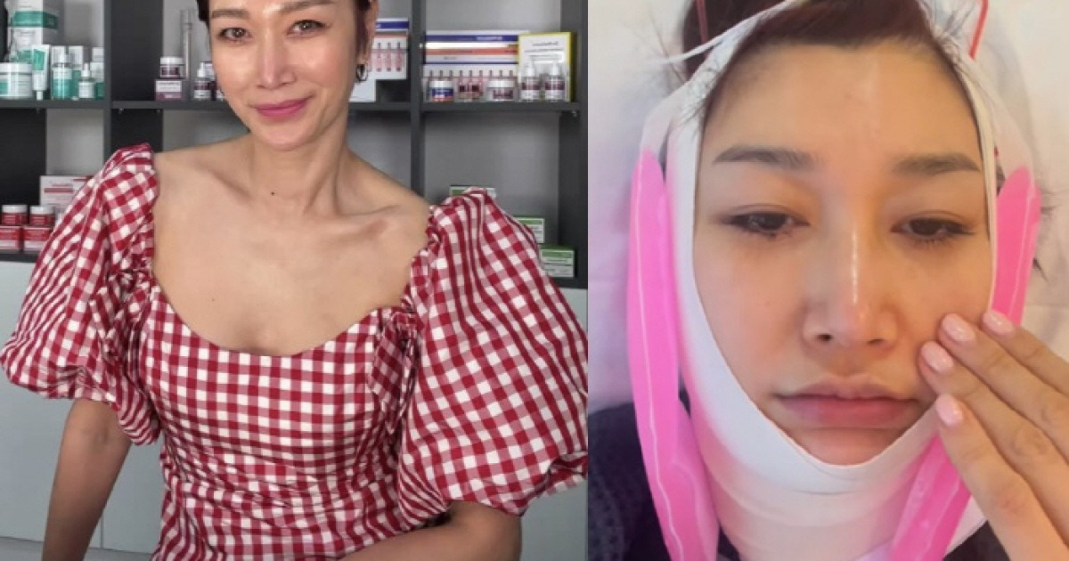 변정수 12년만 갑상선암 수술 흉터 지웠다 침도 삼키기 어려워