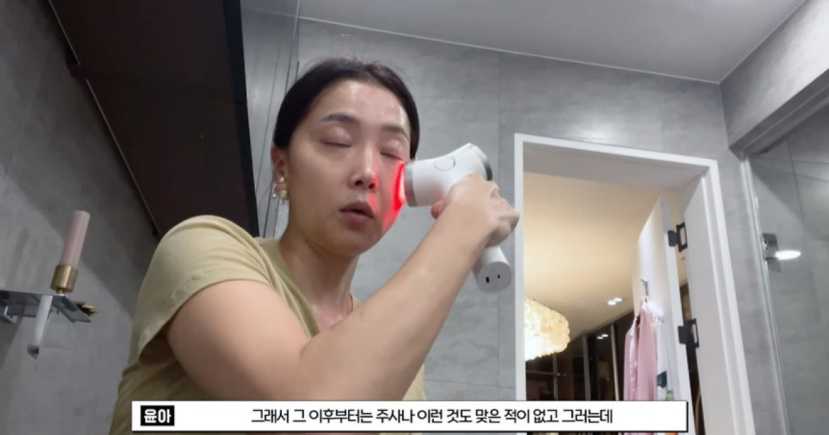 오윤아 보톡스 맞으면 광대 툭 치와와 얼굴 되더라…늙은 건 티가 난다