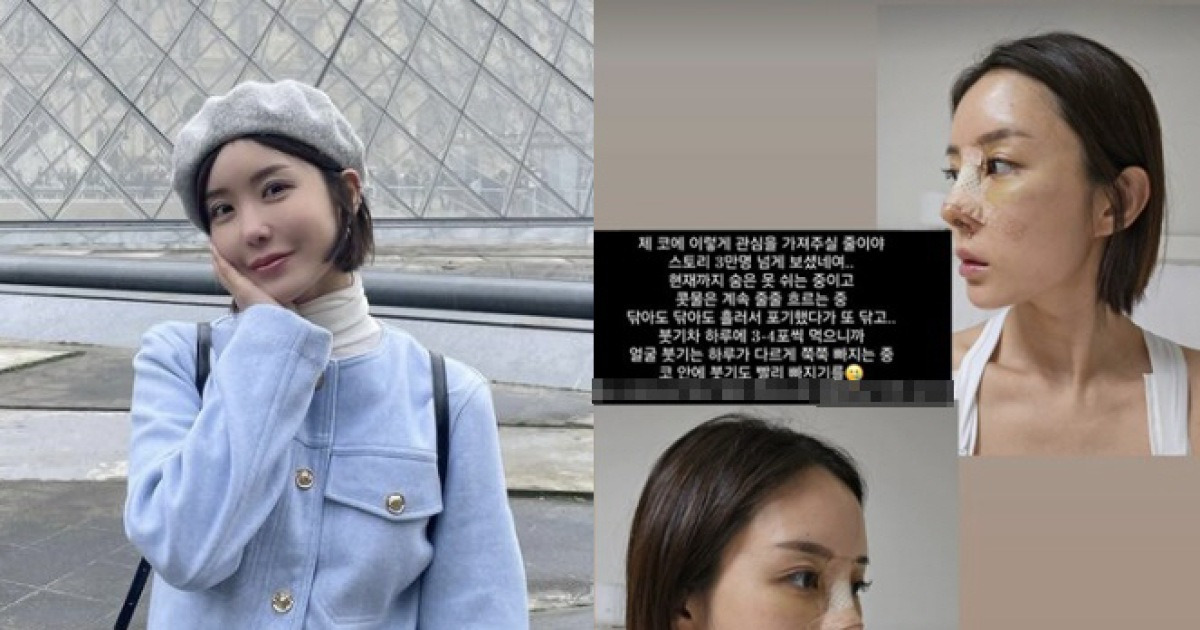 돌싱글즈3 이소라 가슴→코 성형 고백 숨 못 쉬어 아파 죽겠네