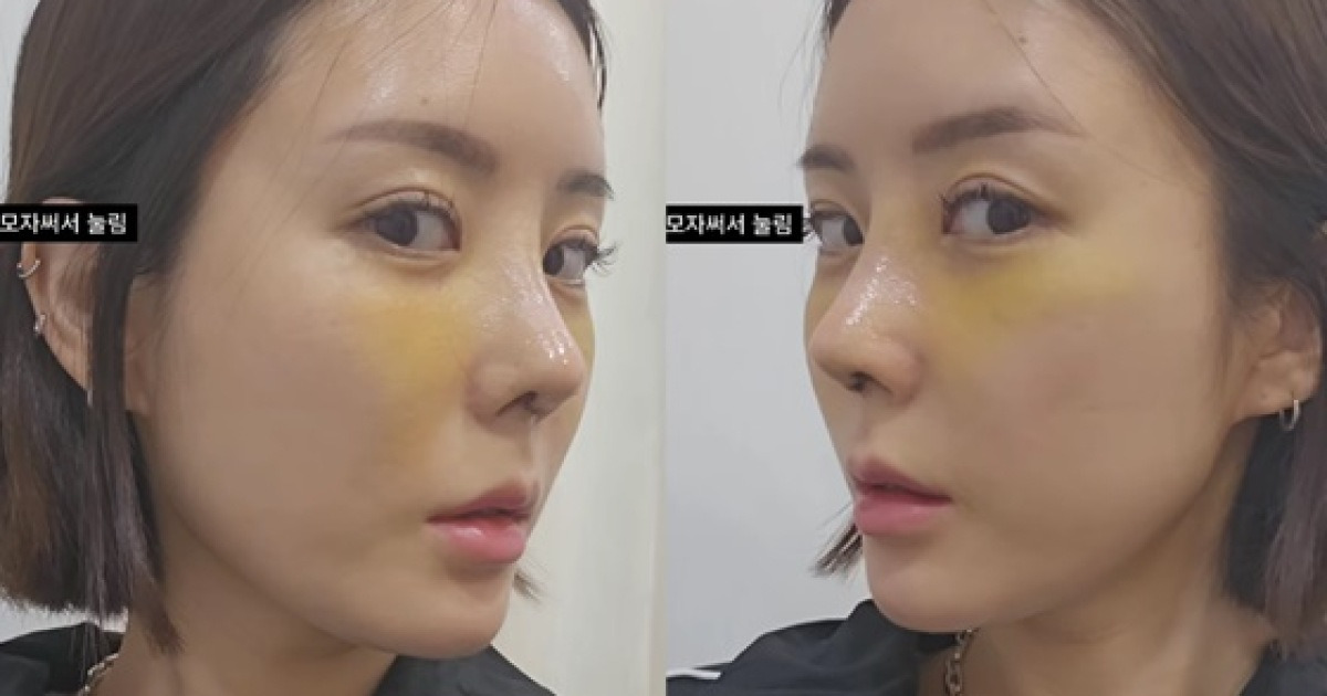 돌싱글즈3 이소라 가슴 성형보다 아팠던 코 수술 후 부기 없는 편