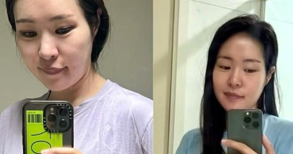 '♥김태현' 미자, 접히던 뱃살 어디 갔나…독한 다이어트 성공 "80kg에서 40kg 대까지"