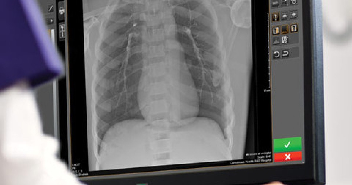 Carestream Introduces Image Suite MR 10 Software to Enhance Imaging ...