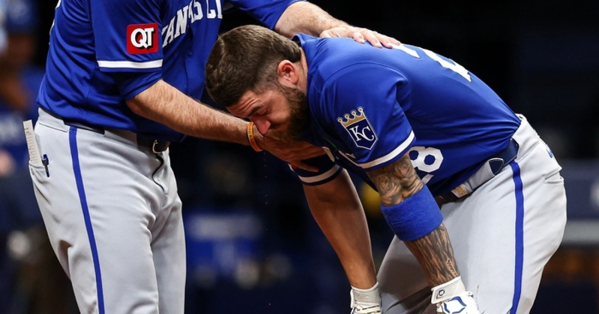 155km/h 파울볼이 얼굴에 ‘퍽’···MLB 캔자스시티 아찔했던 순간