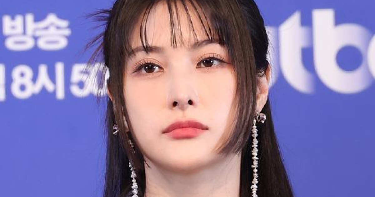 카라 박규리, 광대·안와 골절 부상…완전체 활동 차질 불가피