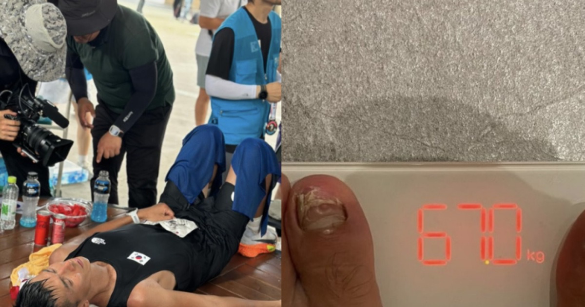 ‘81.5km 완주’ 션, 하루 만에 4.7kg 빠졌다