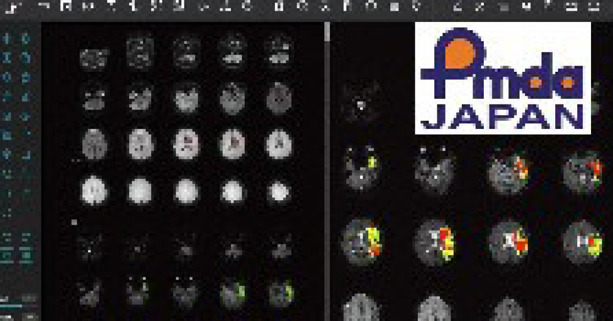 제이엘케이, 뇌졸중 솔루션 日 PMDA에 인허가 신청