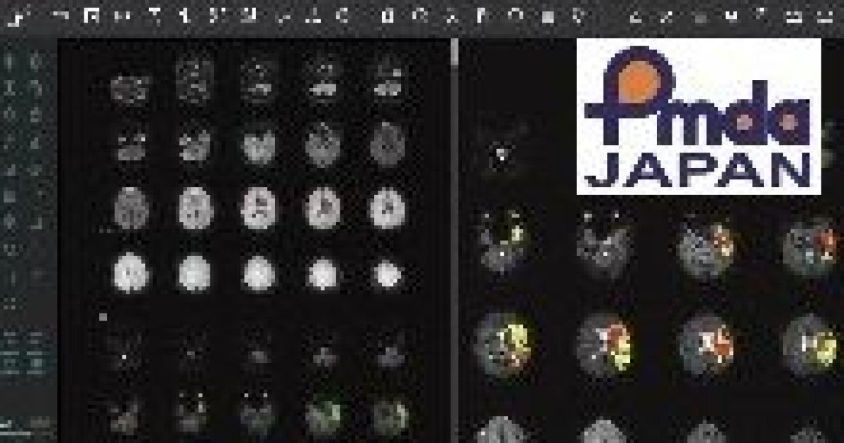 제이엘케이 "뇌졸중 솔루션 日PMDA 인허가 신청 완료"