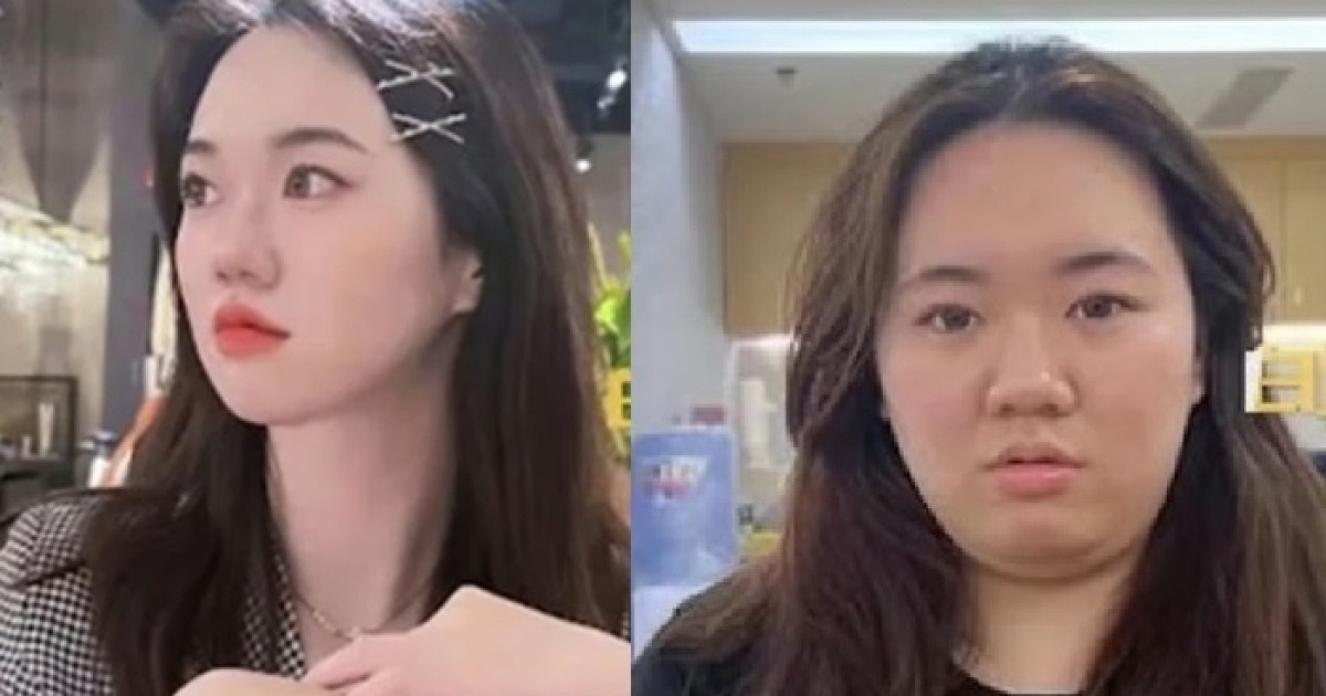 “이게 다 이 녀석 때문”…1년 사이 20kg 찐 중국女, 가장 먼저 한 일