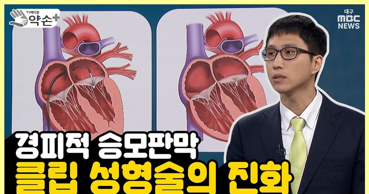 [약손 ] 심장이 보내는 경고 ‘심부전과 심장 판막 질환 ⑭경피적 승모판막 클립 성형술의 진화