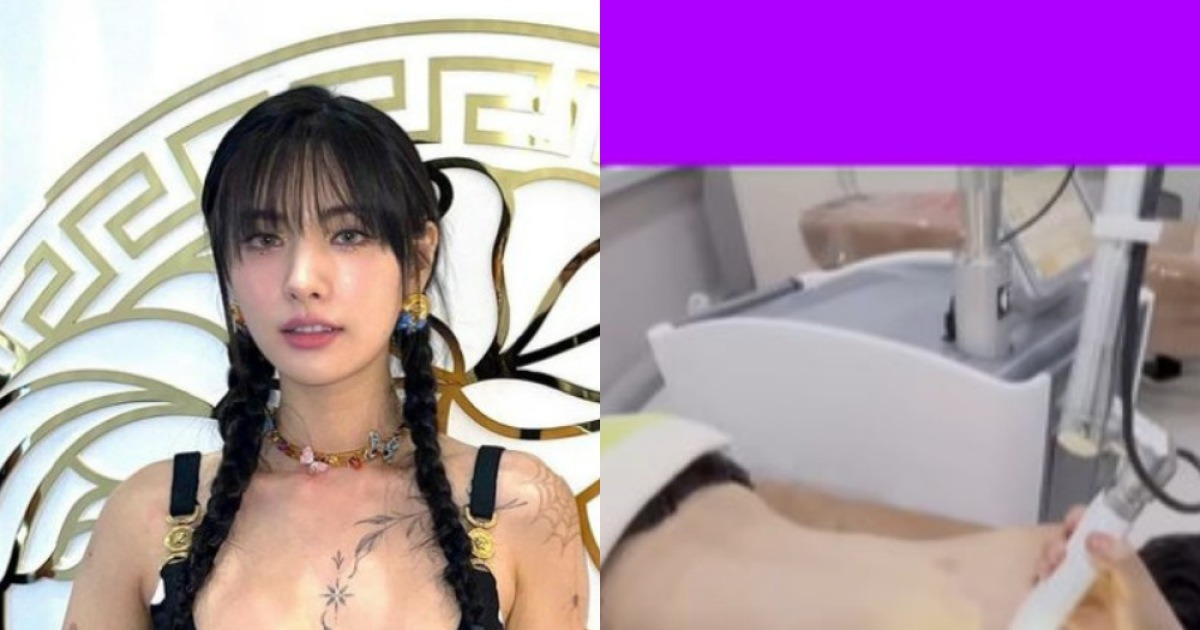 전신 타투 나나 본격 지우는 과정 공개…상의까지 다 벗었다