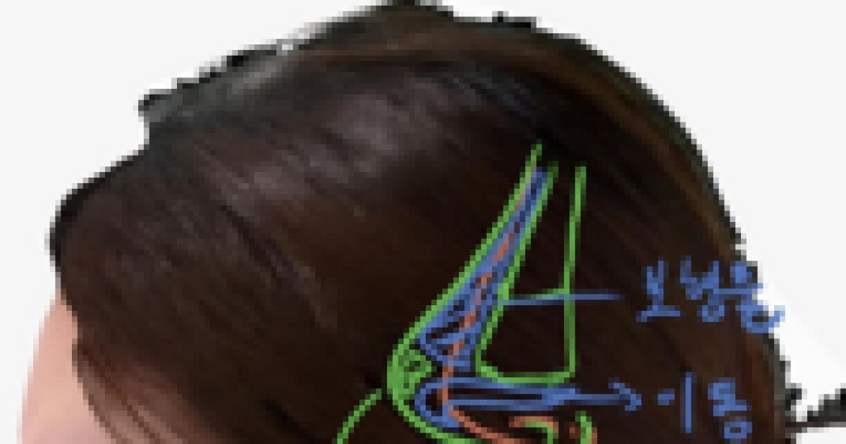 [AI TECH+ 2024] 글래드파크, 뷰티의료용 3D솔루션 'EZ-FACE' 개발