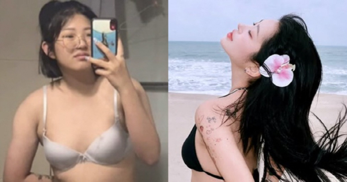 '96kg→49kg' 최준희, 뼈말라 비키니 몸매.."눈·코 이어 양악 욕심" [종합]