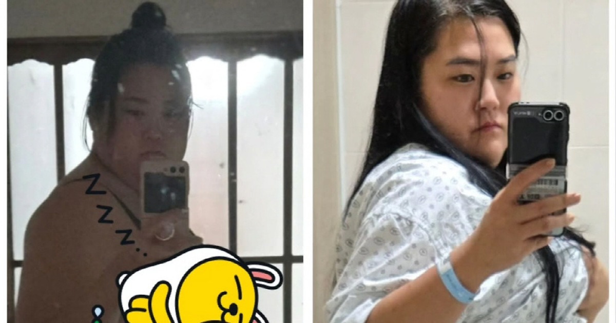 미나 시누이, 놀라운 150→99kg 감량 변화..180도 다른 몸매