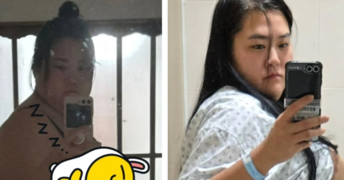 '150kg→99kg' 미나 시누이, 확 달라진 근황 "과거의 나 미안" [MD★스타]