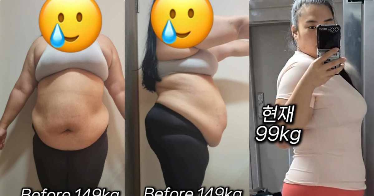 '150kg' 미나 시누이, 50kg 뺐어도 "99kg, 초고도비만..아프지 않기 위해 살 빼야"