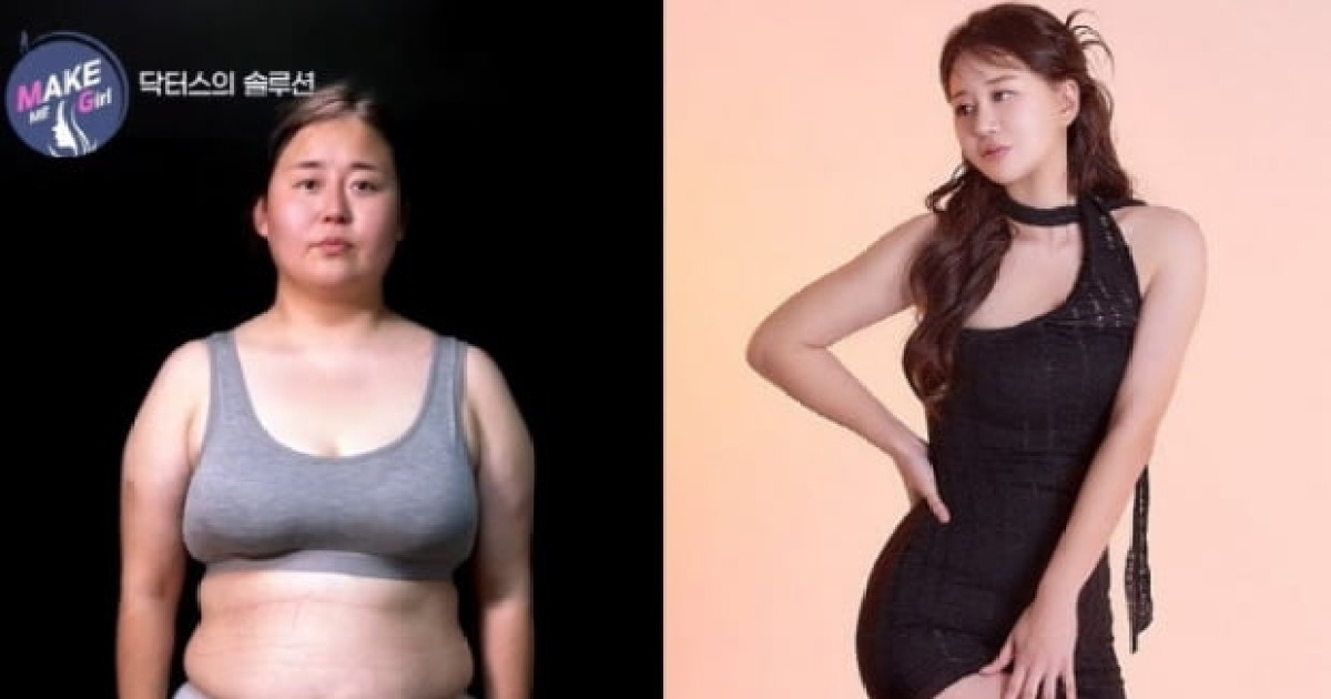 맥미걸, ‘위기의 아내’ 365mc와 지방흡입·30kg 감량 변신 공개