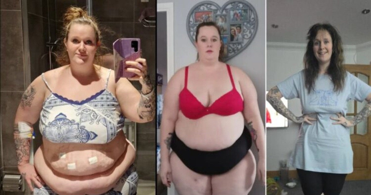 "8살 부터 폭식해 146kg"...'이 방법'으로 63kg 뺀 30세女, 전과 후 식단 보니