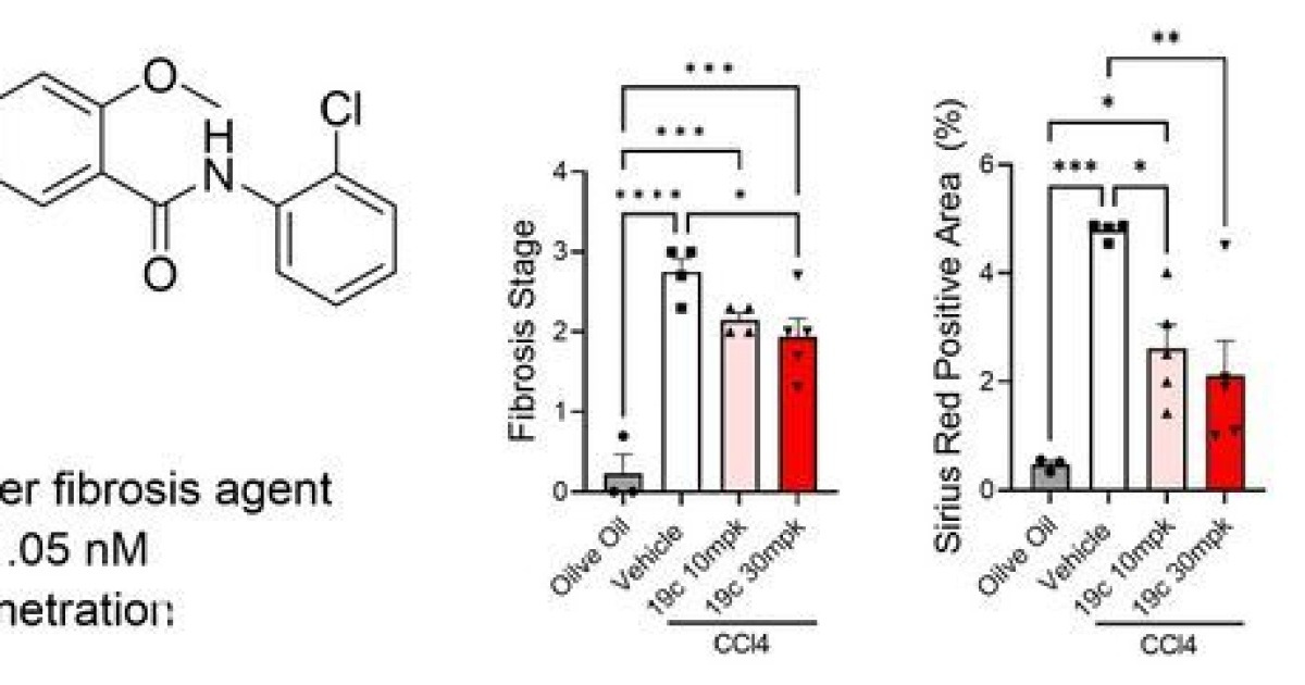GIST-KAIST, 간 섬유화 신약 후보물질 개발