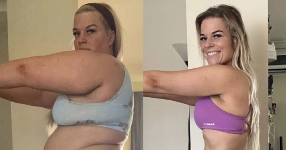 “뱃살 싹 사라졌네” 130kg女 60kg뺐다...1년간 XS로 변한 비결은?