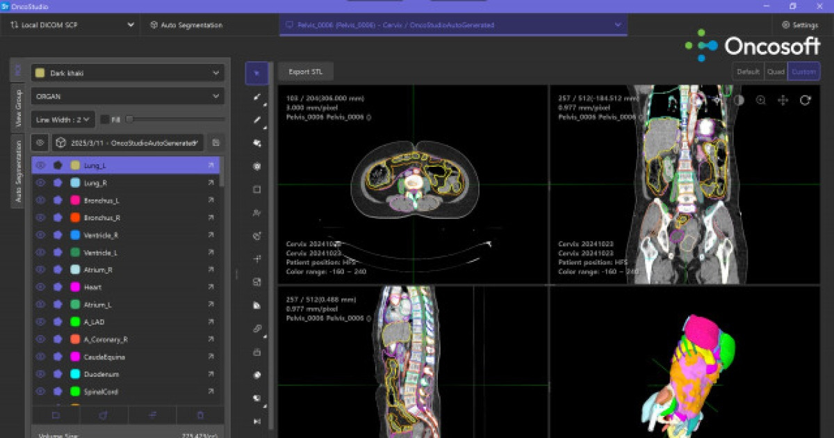 Qt 그룹, 온코소프트의 AI 의료영상 분석 소프트웨어 ‘OncoStudio 2.0’에 개발 플랫폼 지원