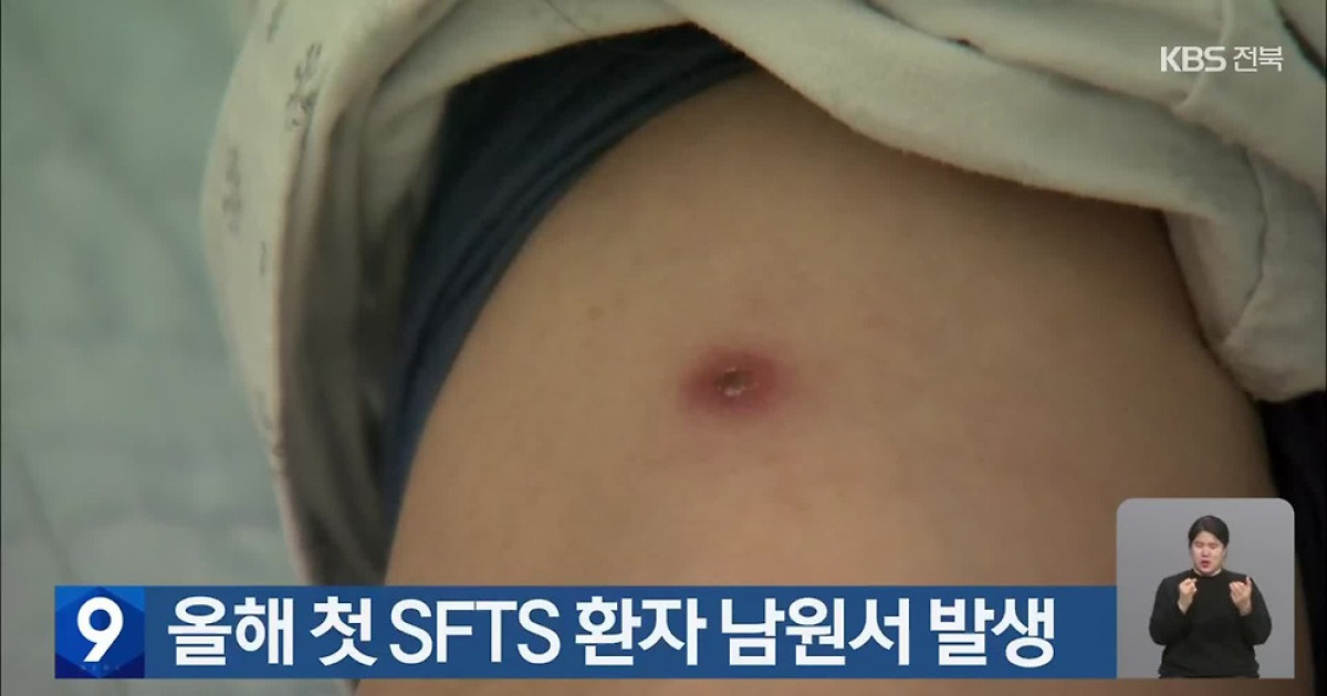 올해 첫 SFTS 환자 남원서 발생