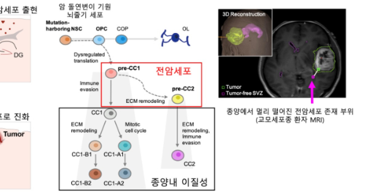 KAIST연구팀, 악성뇌종양의 씨앗 '전암 세포' 첫 규명