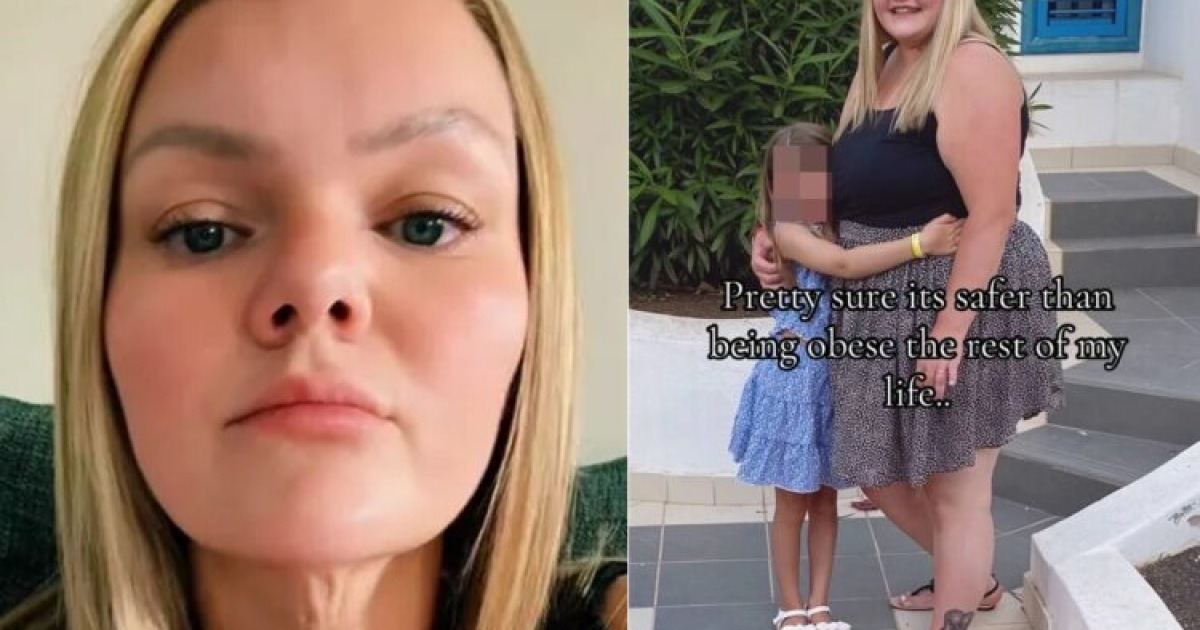 “9주 만에 31kg 뺐지만”…50대처럼 확 늙었다는 30대女, 무슨 사연?