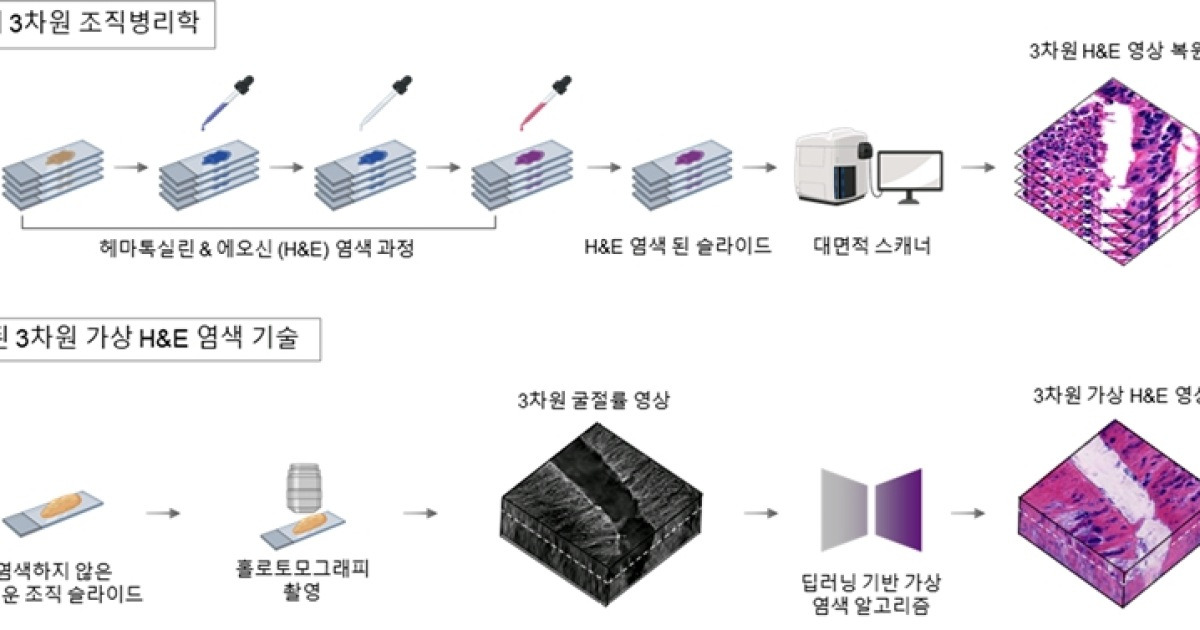 [쿠키과학] '암 조직 입체구조 완벽 분석'… KAIST, 3D 가상염색기술 개발