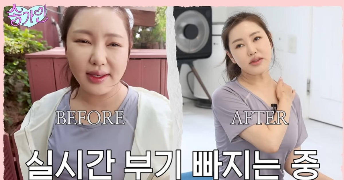 송가인, 몸무게 47kg였는데 외모 악플 시달려…운동 후 부기 싹 빠진 얼굴