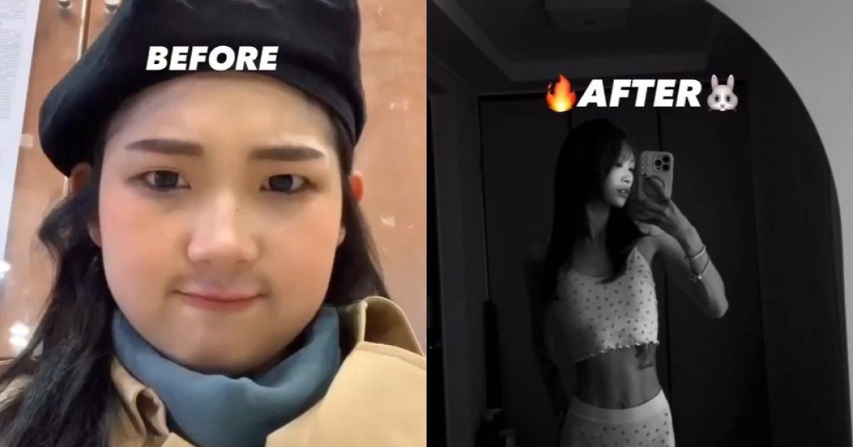 '최진실 딸' 최준희, 96→41kg 다이어트 전후 보니…극단적 감량 '충격'