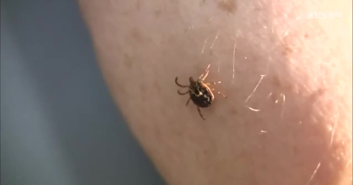 의료진까지 SFTS 2차 감염…실태와 유의점은?