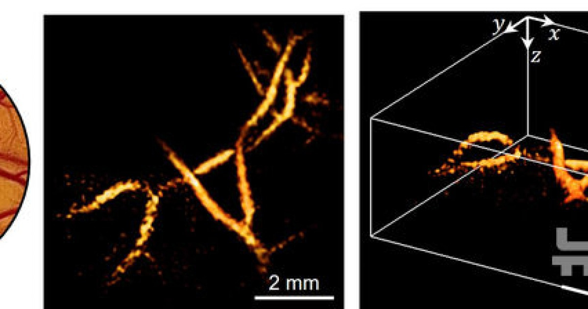피부 접촉 없이 생체 내부 3D 영상화… GIST-고려대, 세계 첫 개발