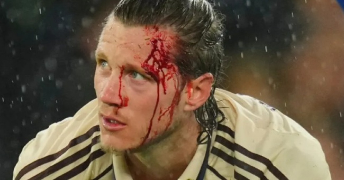 [UCL ISSUE] 피가 철철, 이마가 찢어졌다→PK 허용까지...맨유 출신 FW 수난 시대