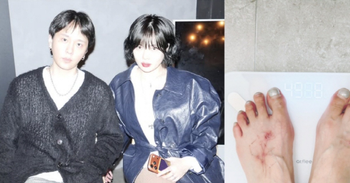 '한달만 -10kg' 현아, ♥용준형과 꽁냥…발등엔 선명한 타투 흉터[SCin스타]