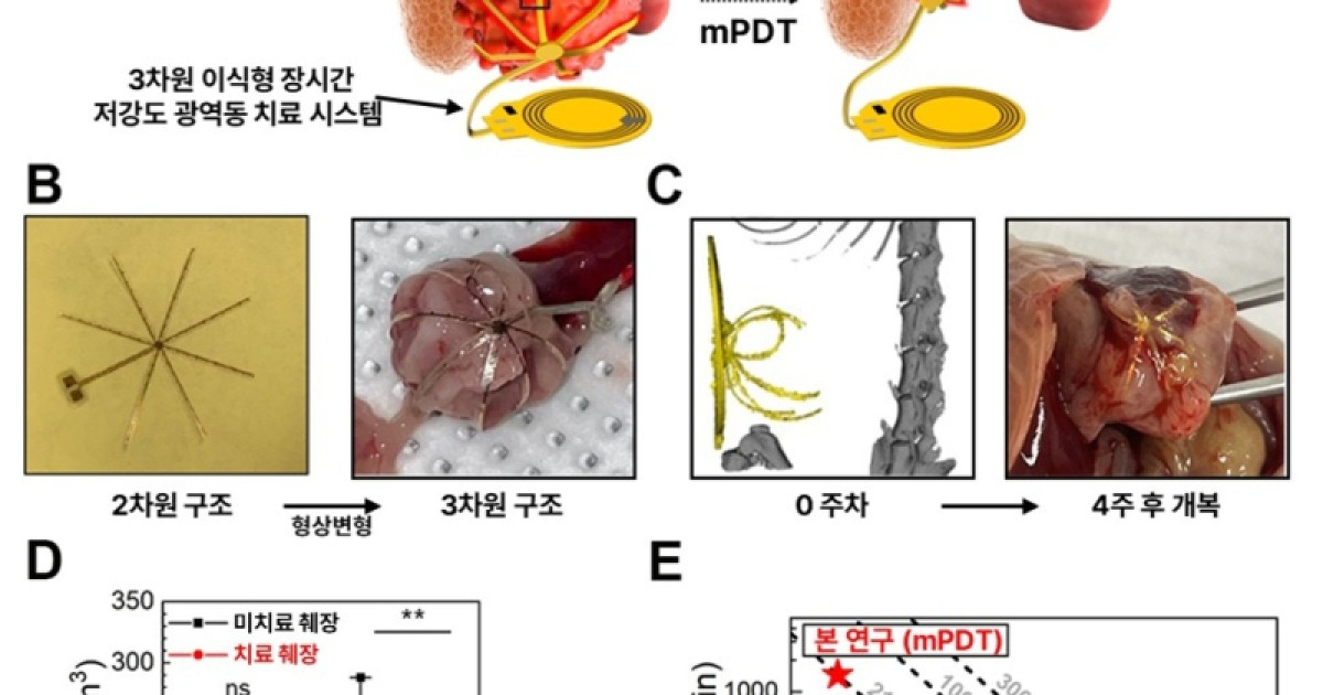 [쿠키과학] "3일 만에 종양 64% 제거"… KAIST-UNIST, 췌장 감싸는 ‘3D 마이크로 LED’ 개발