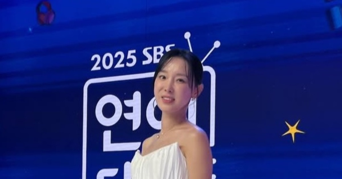 이지혜, '인중축소술' 심경 밝혔다 "자연스러워질 것, 너무 뭐라 하지 말아달라"