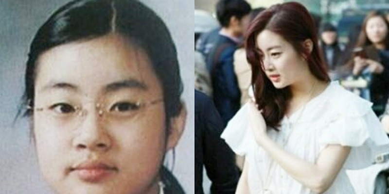 '72kg에서 20kg 감량' 다이어트로 인생 역전한 여배우들 | 뉴스에이드