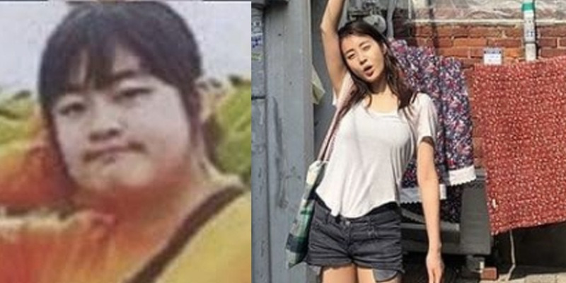 72kg에서 20kg감량하고 체형 교정해 확 달라진 연예인 | 어썸클